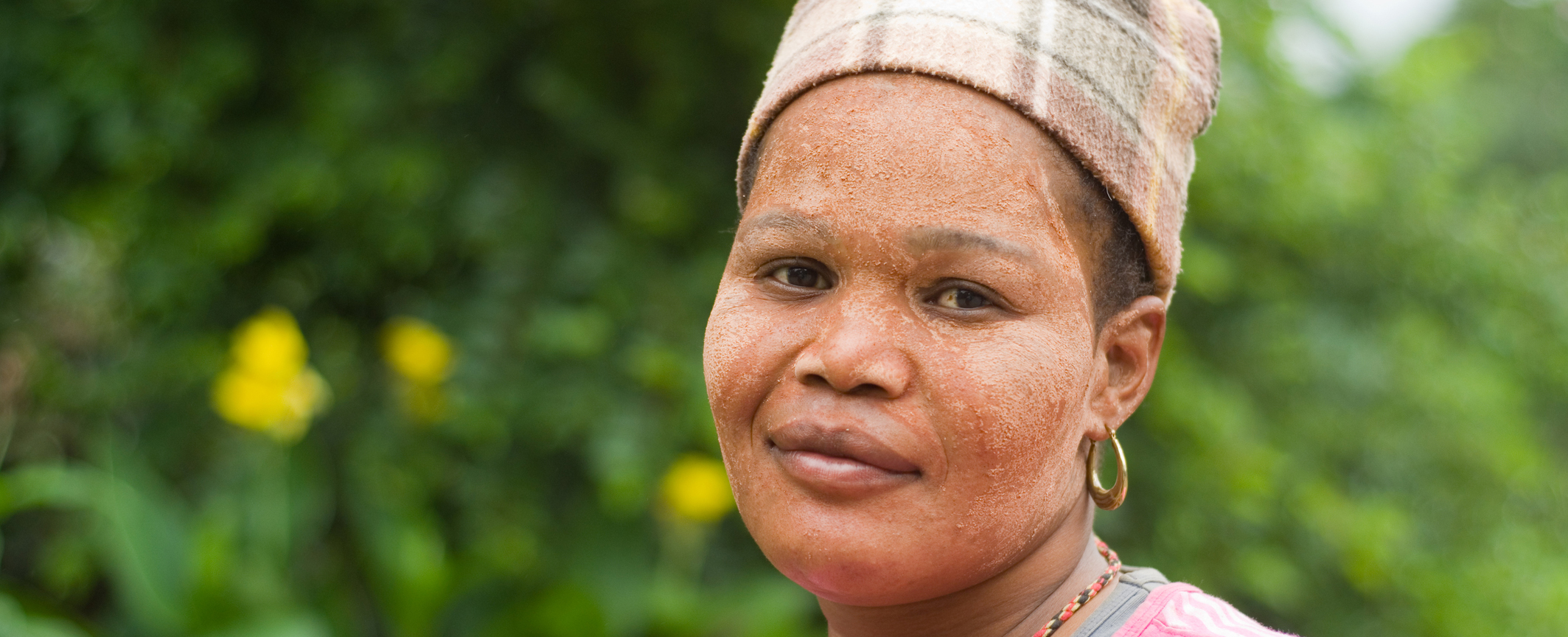 Cancer | WHO | Regional Office for Africa