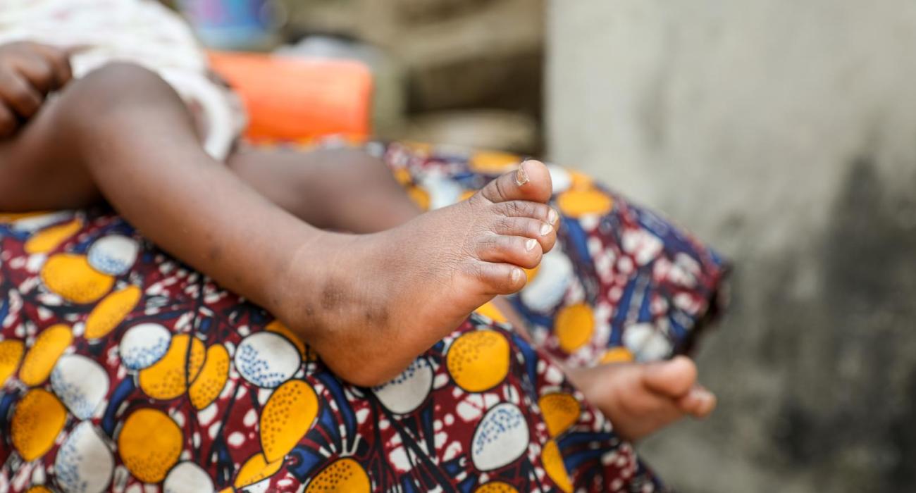 Namibia | WHO | Regional Office for Africa